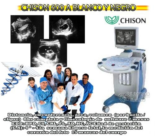 Ultrasonido fijo chison 600a blanco y negro en Jalisco - Otros ...
